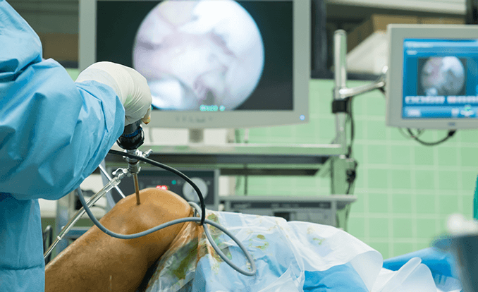 ACL Reconstruction Surgery | ACL Surgery Singapore - IOC Ortho