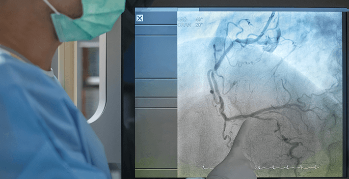 Interventional Radiology Pain Management