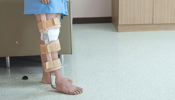 ACL Reconstruction Surgery | ACL Surgery Singapore - IOC Ortho
