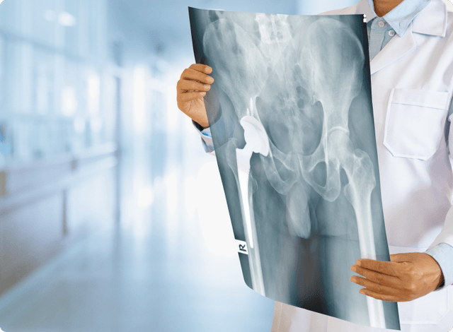 Hip Labral Tear Surgery Singapore | Hip Labral Specialist - IOC Ortho